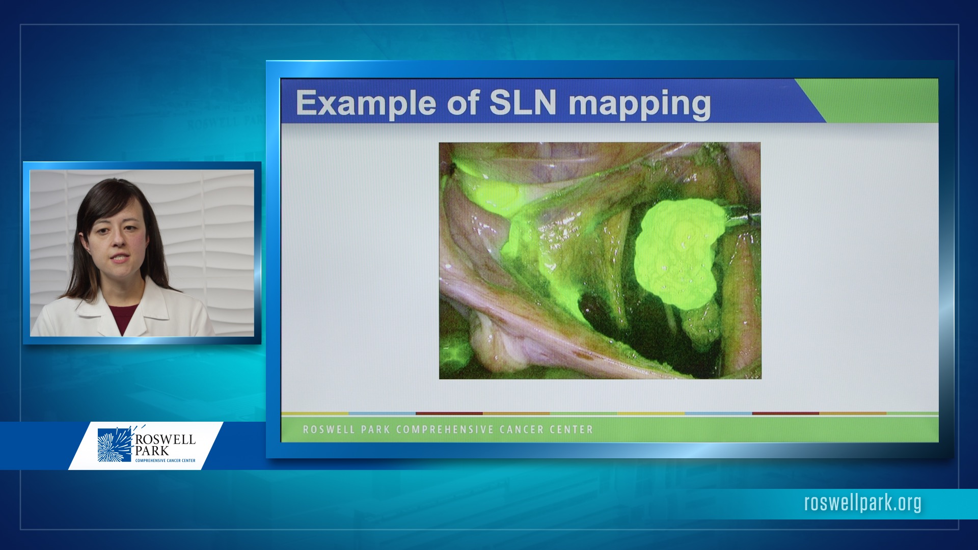 Sentinel Lymph Node Mapping In Endometrial Cancer Broadcastmed