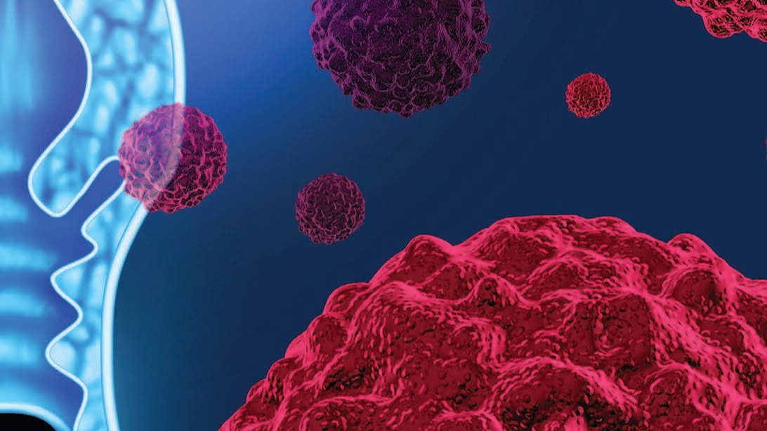 GYNECOLOGIC CANCER PROGRAM - Physician Resources | Fox Chase Cancer Center
