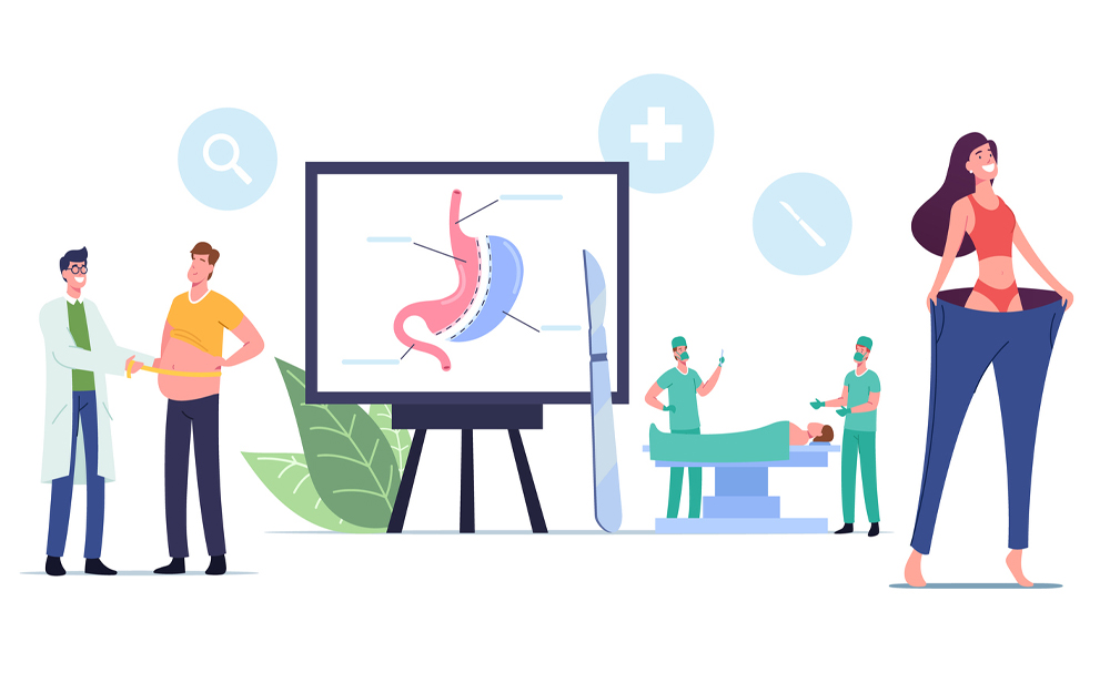 Bariatric Surgery Myths and Misconceptions - Cedars-Sinai Pulse
