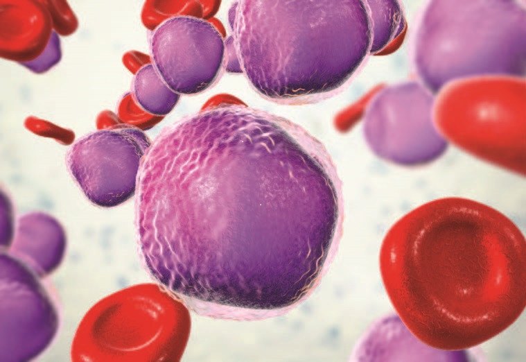 Blood and Marrow Transplant Program - UCSF Pediatrics