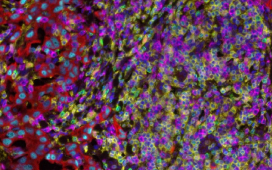 A Cancer Innovation Engine: 10 Roswell Park Research Advances to Look ...