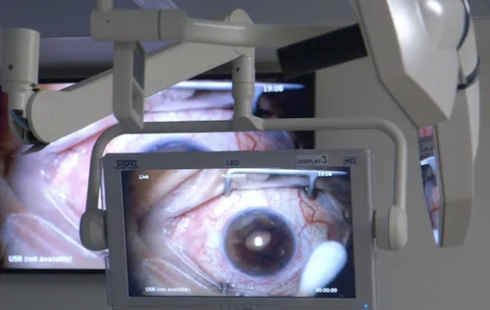 Breaking Ground in Eye Cancer Research, Diagnosis, and Treatment - UT ...