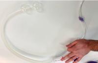 Endoscopic submucosal dissection of a laterally spreading tumor in the ...