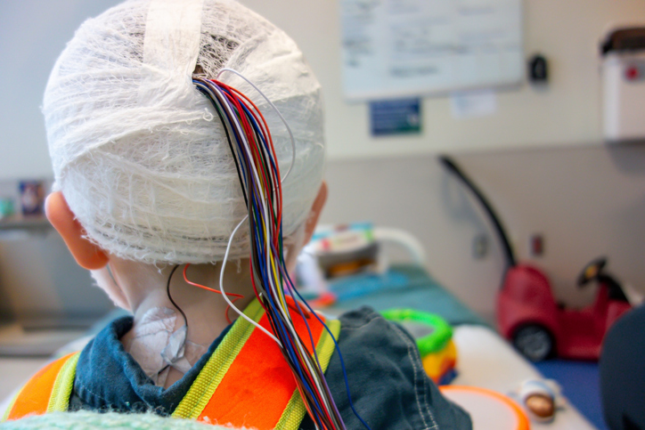 The Future of Pediatric Epilepsy Surgery Through a Genetic Lens ...