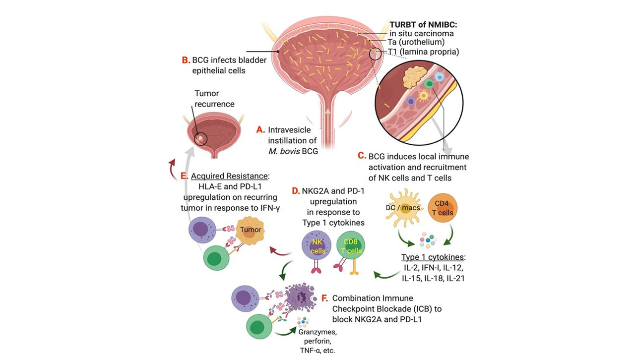 A Mount Sinai Team of Urologic Researchers Advances a Unique Model of ...
