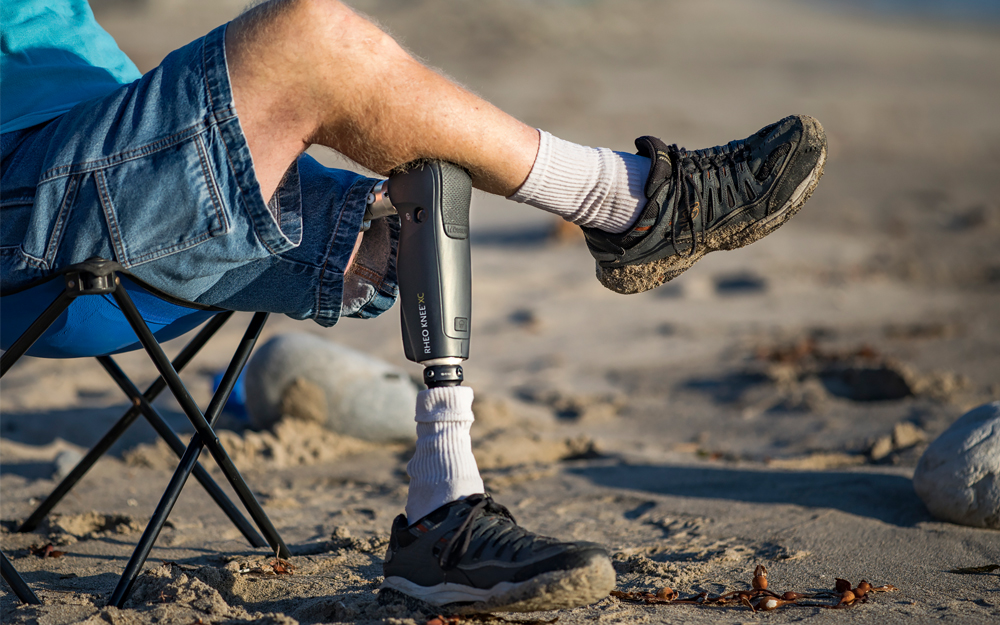 Cedars-Sinai Introduces New Limb Reconstruction Program - Cedars-Sinai ...