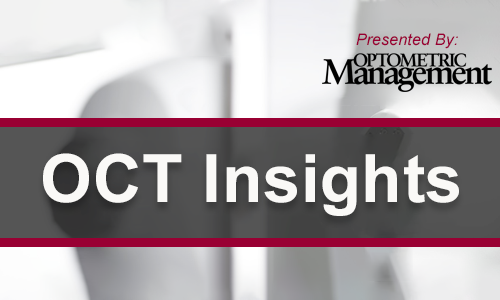 Use Your OCT’s Hood Report to Your Advantage - BroadcastMed