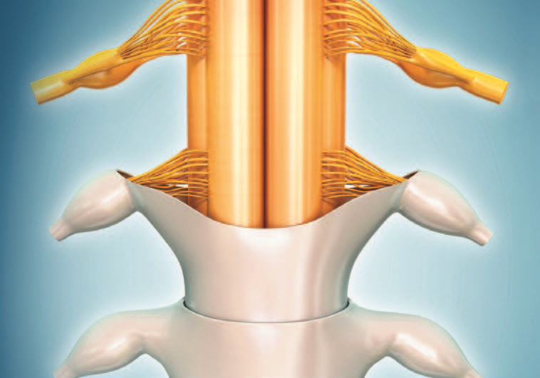 Pediatric Spine Center - UCSF Pediatrics