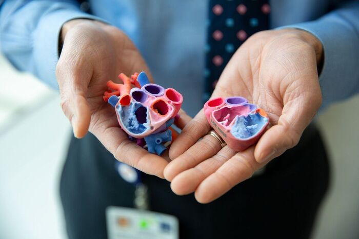 How 3D Printer Heart Technology Changed a Teen’s Life - UCSF Pediatrics