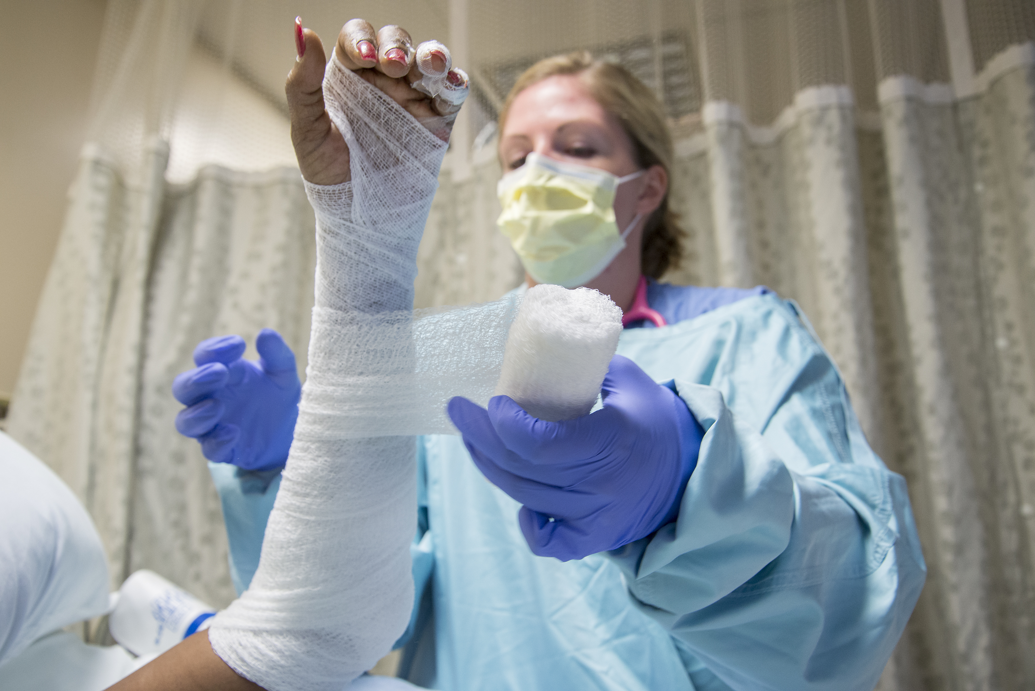 Burn Surgery