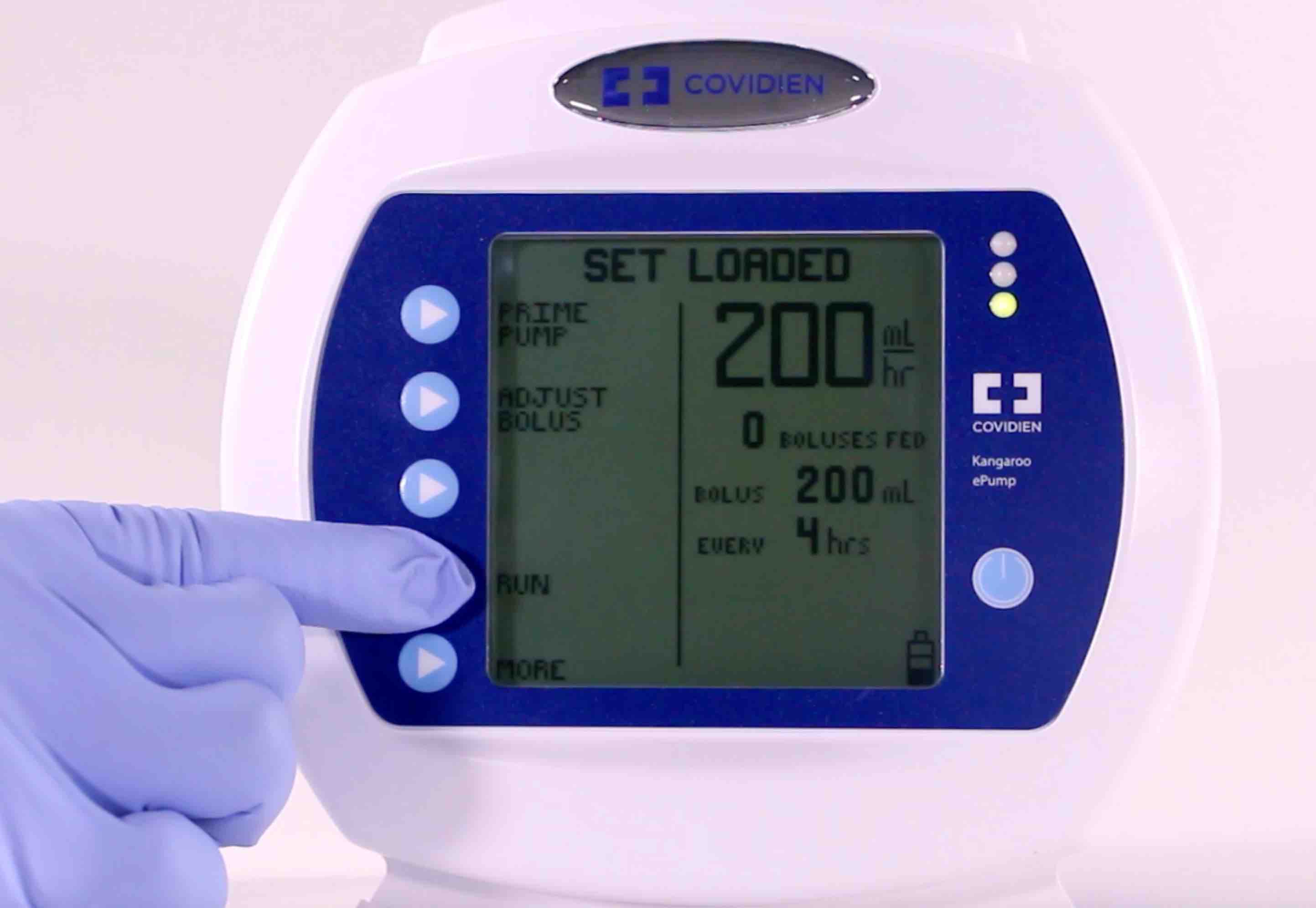 Using the Intermittent Mode Feature of the Kangaroo™ ePump for Feeding ...