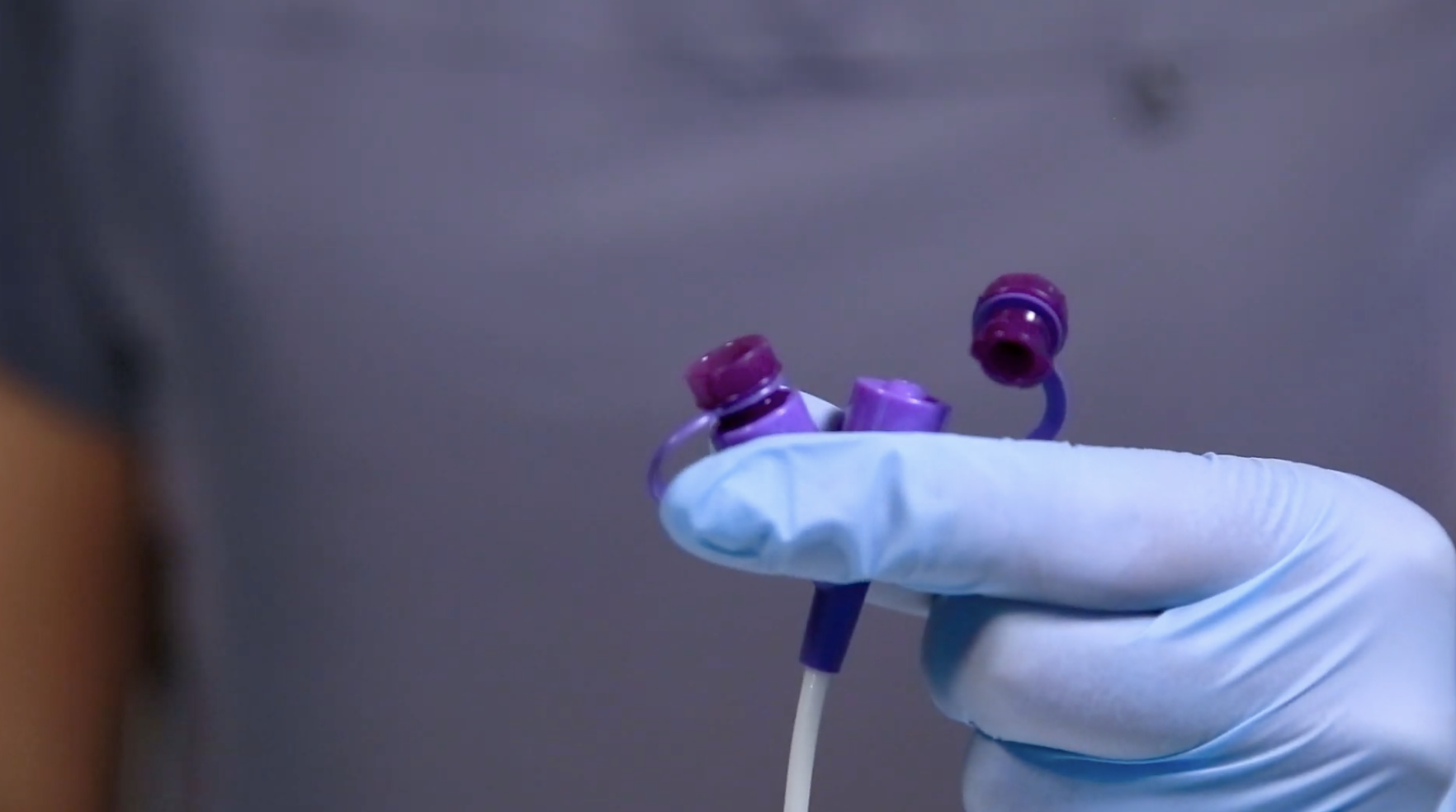 Best Practices for Connecting Kangaroo™ Nasogastric Feeding Tubes with ...