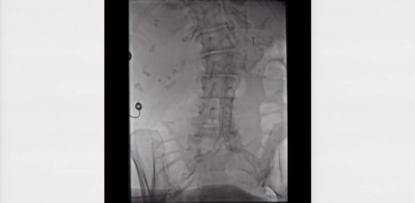Catheter Skills for the Cardiac Surgeon: Catheters, Wire, Approaches ...