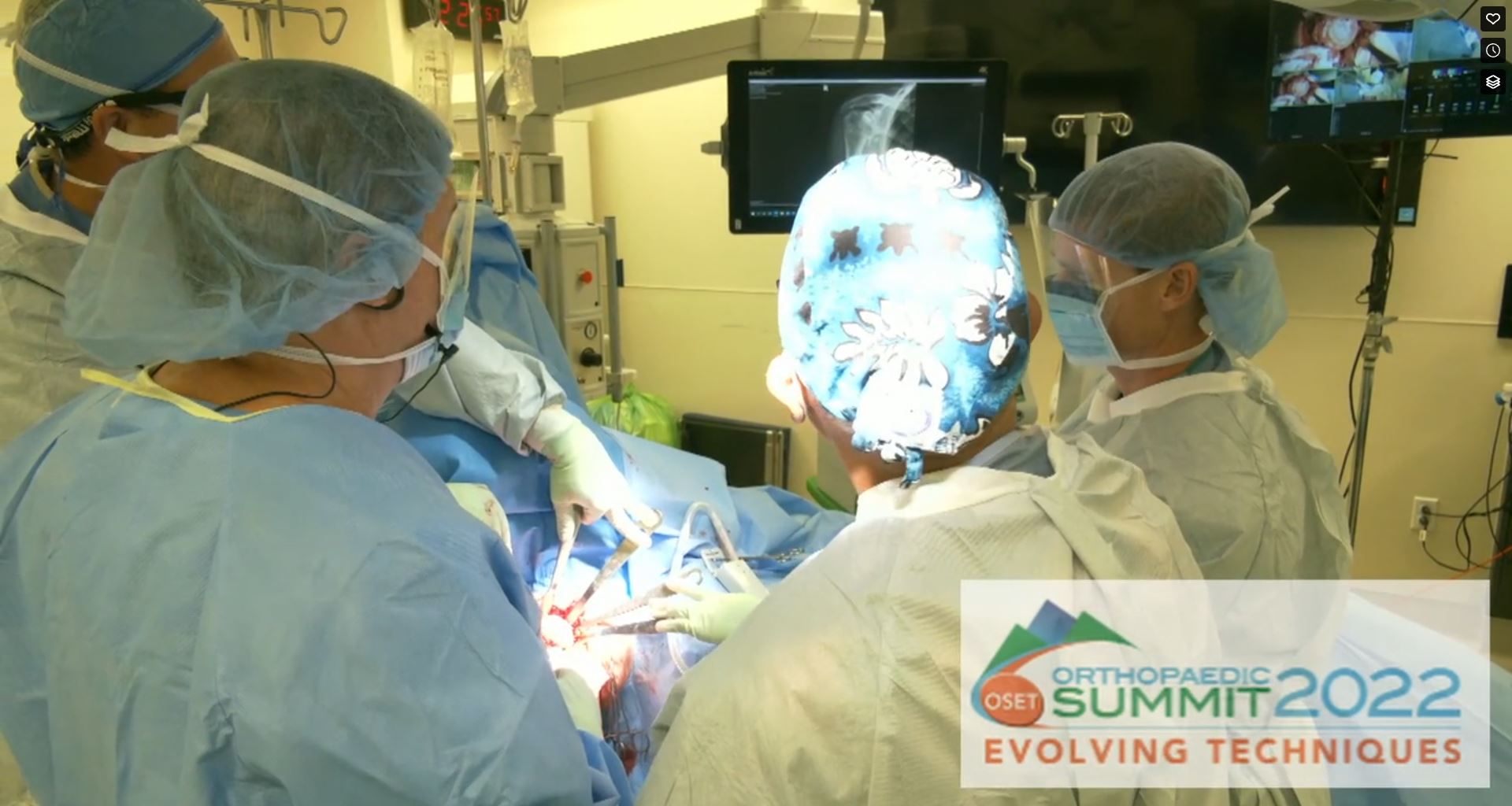 Resection Arthroplasty Boston Shoulder Institute